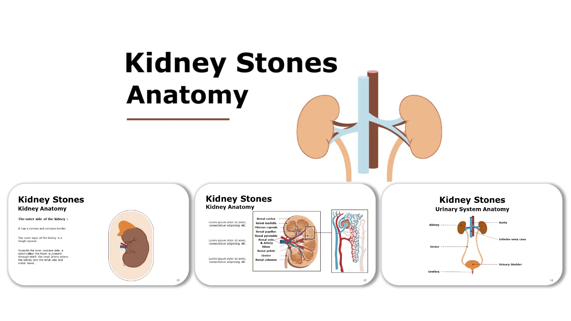 Download kidney Stones PowerPoint Template|RxSlides